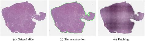 Eswa 2023 Promil A Weakly Supervised Multiple Instance Learning For Whole Slide Image