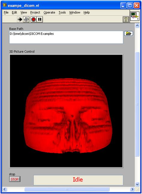 How To Use Ni Biomedical Startup Kit 30 Source Code Load And Visualize Dicom Images In