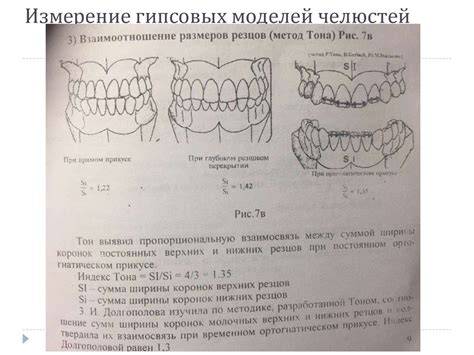 Методы обследования детей для оценки морфологического состояния зубочелюстного аппарата