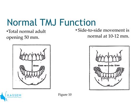 Anatomy Of Tmj Pdf