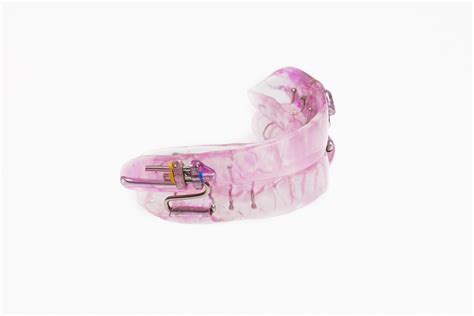 What To Expect From Your Sleep Apnea Oral Appliance Dental Signal