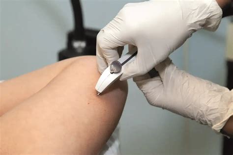 Signs Nexplanon Is Wearing Off Med Supply Solutions