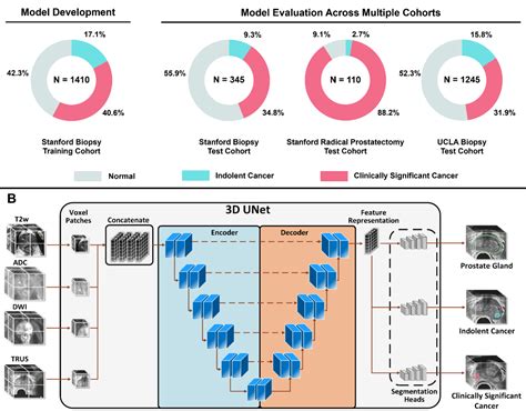 [论文审查] Multimodal Mri Ultrasound Ai For Prostate Cancer Detection Outperforms Radiologist Mri