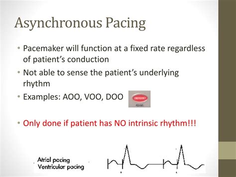 Ppt Ekgs And Pacemakers Powerpoint Presentation Free Download Id