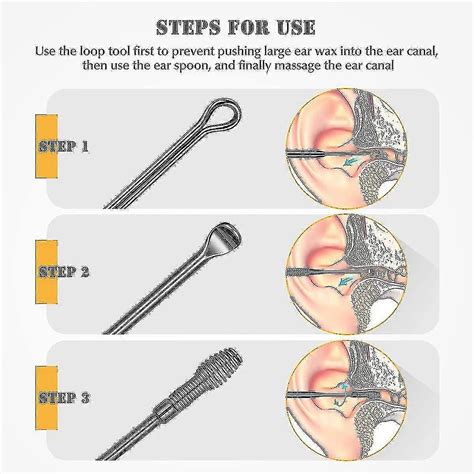 Fong Fong Ear Wax Removal Kit Ear Pick Tools Stainless Steel 6 In 1
