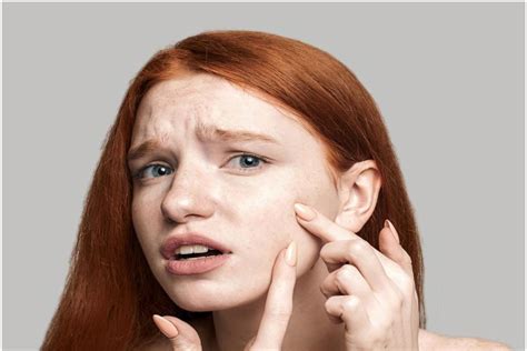 أعراض سرطان الجلد للمراهقين هكذا تتجنبها الكونسلتو