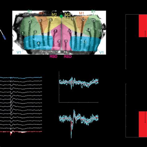 Stencil Printed Flexible Graphene Ecog Array A Stencil Printing Download Scientific
