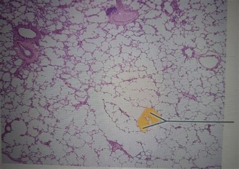 Solved Identify The Structure Chegg