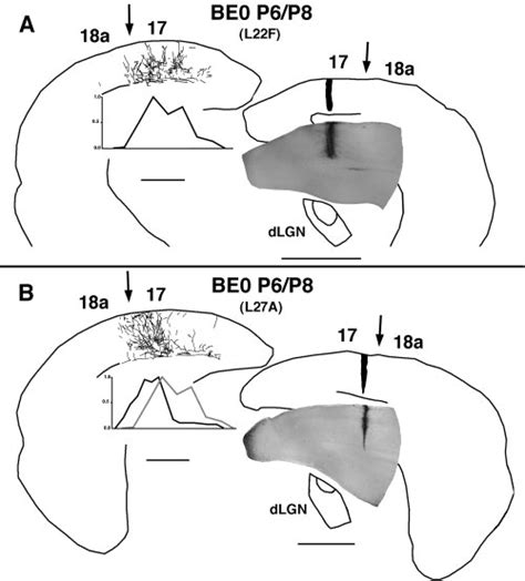 Organization Of Callosal Projections Revealed With The Anterogradely