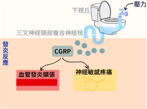 Cgrp單株抗體藥物：慢性偏頭痛的突破性治療 Neurodrlee