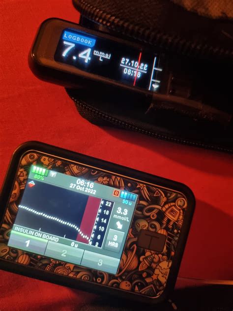 4 Hours Of Sleep Thanks To The Dire First 24h Of A New Dexcom Application Ready To Throw It Or