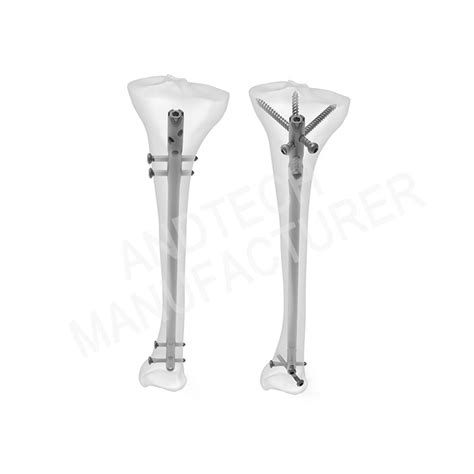 China Tibia Intramedullary Nail System Manufacturer And Supplier And