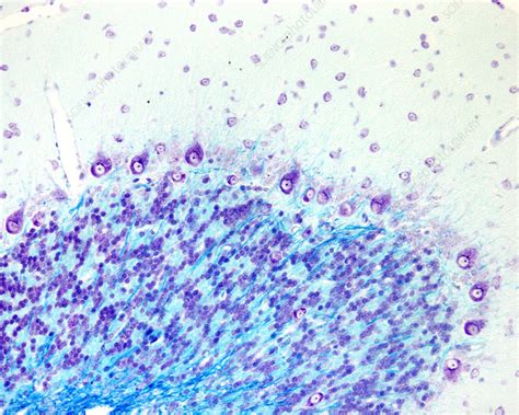 Cerebellar Cortex Light Micrograph Stock Image C059 3813 Science Photo Library