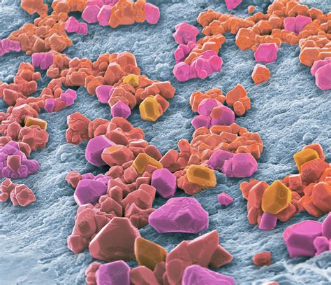Albumin Crystals Sem Stock Image C0584968 Science Photo Library