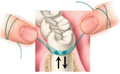 The Importance Of Flossing Main Street Dentistry Dentists