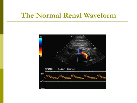 Ppt Renal Artery Doppler Powerpoint Presentation Free Download Id