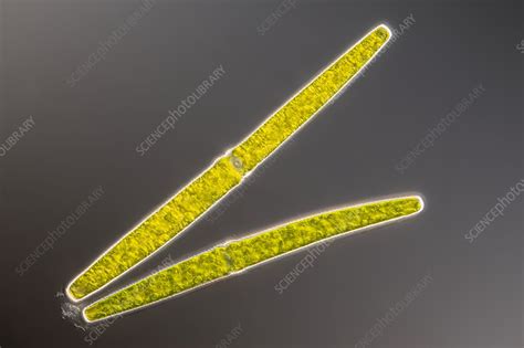 Pleurotaenium Trabecula Algae Light Micrograph Stock Image C056 9215 Science Photo Library