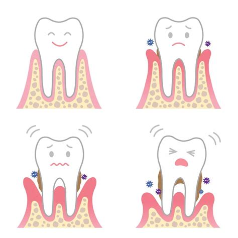牙周健康 状态 大山谷图库
