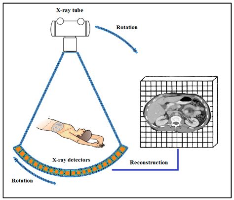Radiation Detectors And Sensors In Medical Imaging
