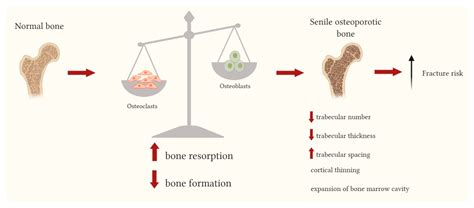 Bone Remodeling Process Diagram Bone Biology