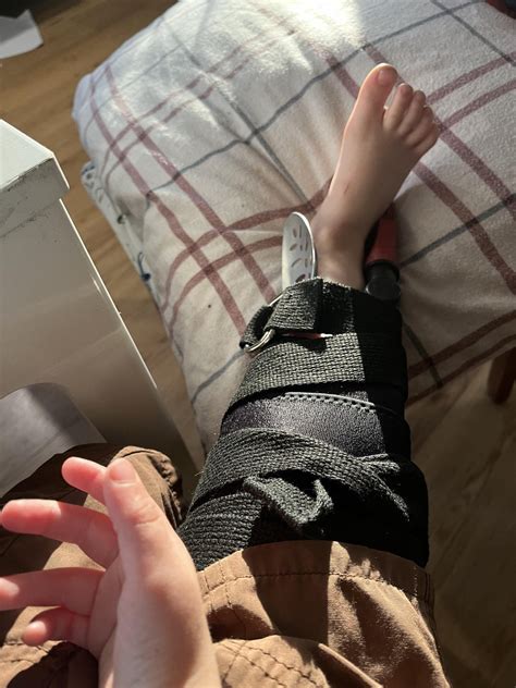 My 4 Year Old Wanted His Own “robot Leg” For His “owie” Like Mommy 😂 R Acl