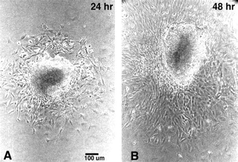 Neural Crest Migration From Neural Tube Explant Cultures Neural Crest Download Scientific