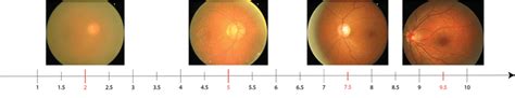 an example of different dfis used for the reference set image a is