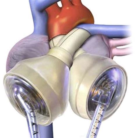 Heartware Ventricular Assist Device Heartware Inc Framingham Ma