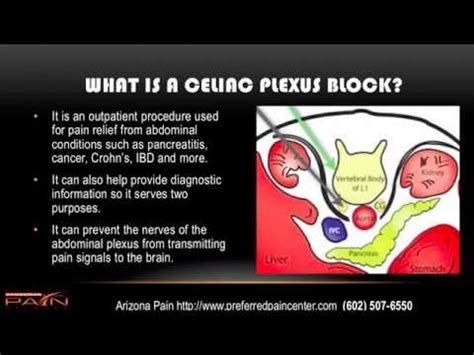 Celiac Plexus Block