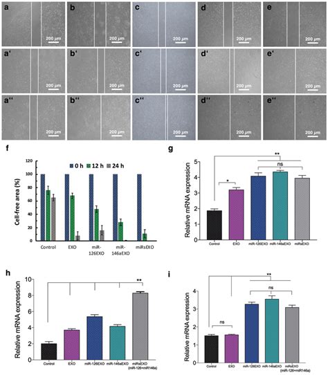 Migration Assay Ae″ Microphotographs Of Scratch Migration Potential Download High