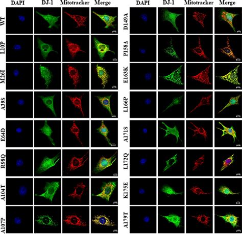 Subcellular Localization By Indirect Immunofluorescence Of Human Wild Download Scientific