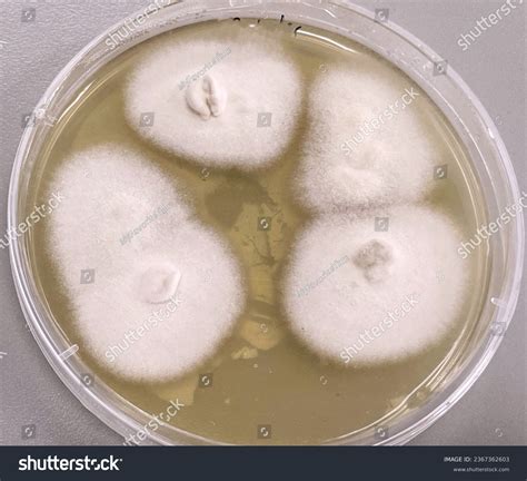 Microsporum Gypseum