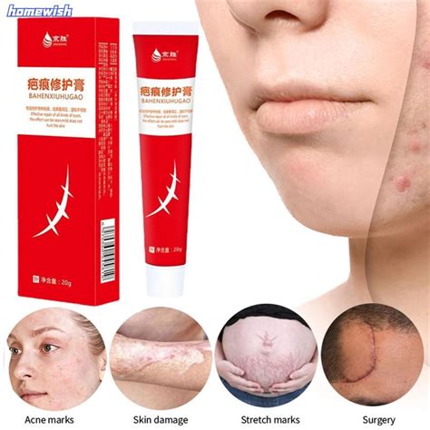 Homewish Scar Repair Cream Acne Remove Gel Acne Pits Acne Scars Spots