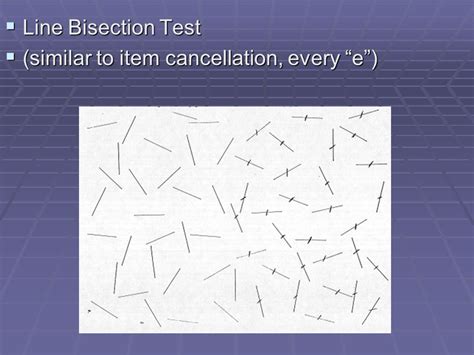 Line Bisection Test Printable Mafiadoc Com Download Figure 101