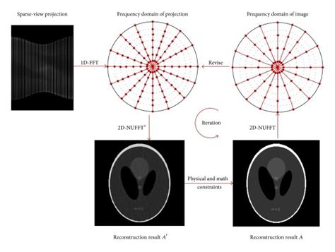 The Flowchart Of Sparse View Image Reconstruction For The Model