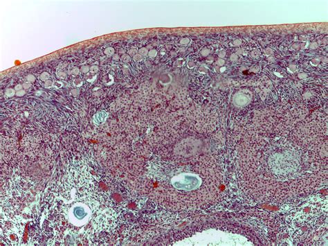 Female Ovary Histology 10x Diagram Quizlet Female Ovary Histology 10x Diagram Quizlet