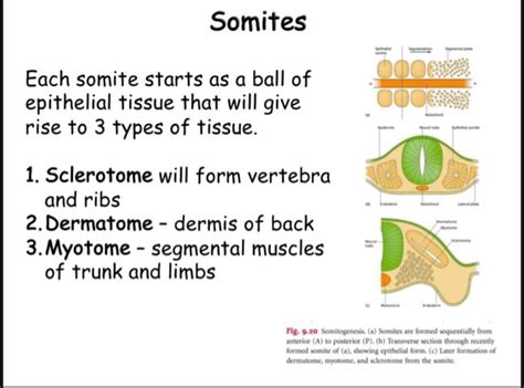 Solved Activity 2 1 What Part Of The Somite Gives Rise To