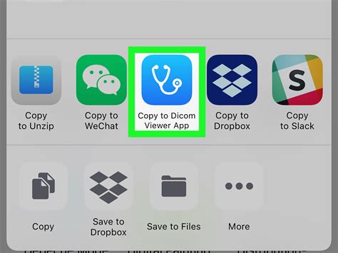 How To Open A Dicom File On Iphone Or Ipad 13 Steps
