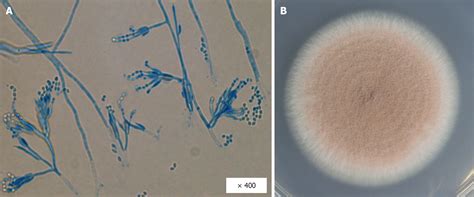 Purpureocillium Lilacinum A Minireview