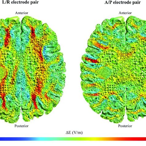 Current Density And Field Distribution In Context Of Anisotropic Tissue Download Scientific