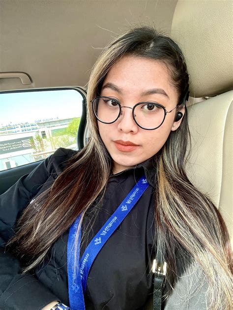 Almost A Year Off Accutane R Accutane