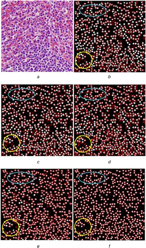 Comparative Nuclei Detection Performance Illustration For Different
