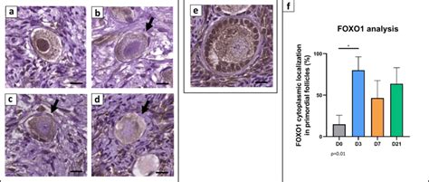 Foxo1 Immunostaining In A Primordial Follicle In Non Grafted Ovarian Download Scientific