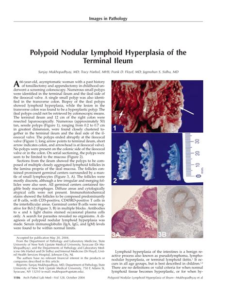 Pdf Polypoid Nodular Lymphoid Hyperplasia Of The Terminal Ileum