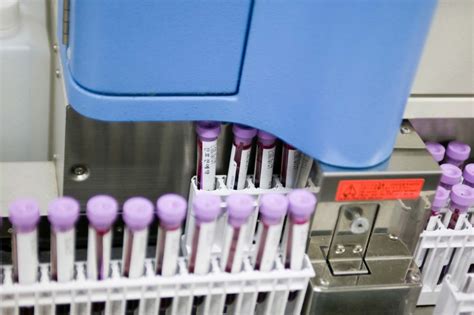 Using Genetic Testing To Prevent Dpd Toxicity The Pharmaceutical Journal