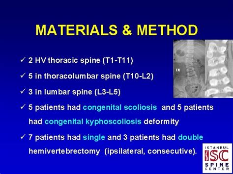 Posterior Hemivertebra Resection And Short Segment Fusion With
