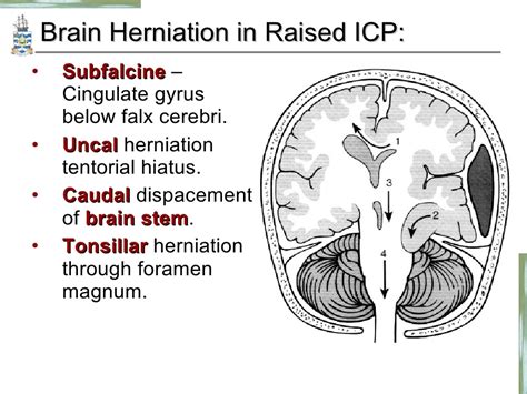 Ppt Pathology Of Meningitis And Cns Infections Powerpoint Presentation