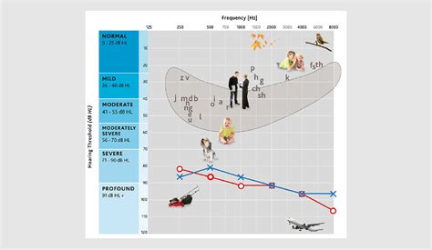 Degrees Of Hearing Loss — Hearing Health Foundation