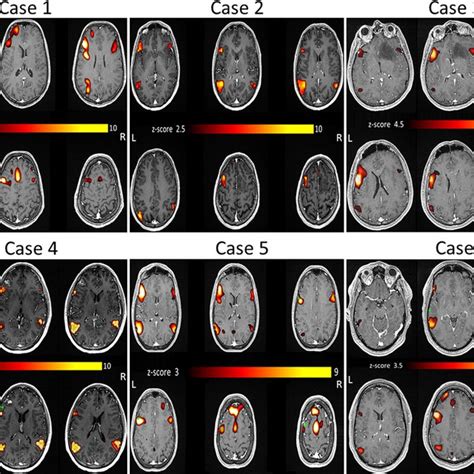 Flowchart Of The Rs Fmri Data Analysis Pipeline Implemented In Download Scientific Diagram