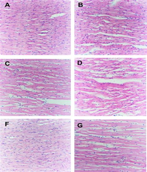 Heart Histopathology Control Group Shows Normal Tissue A G2 B